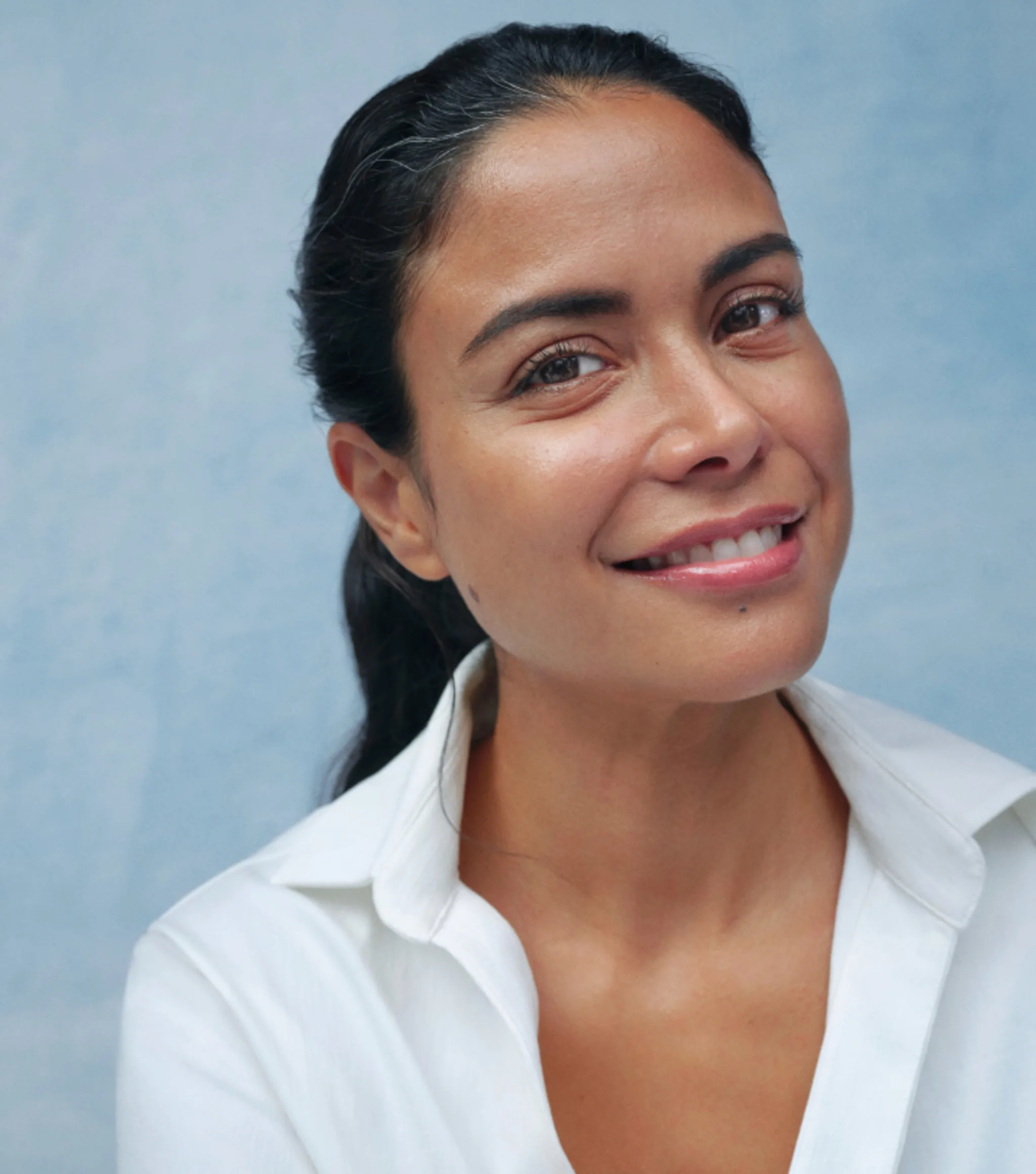 Collection Of Dermal Fillers JuvÉderm® Official